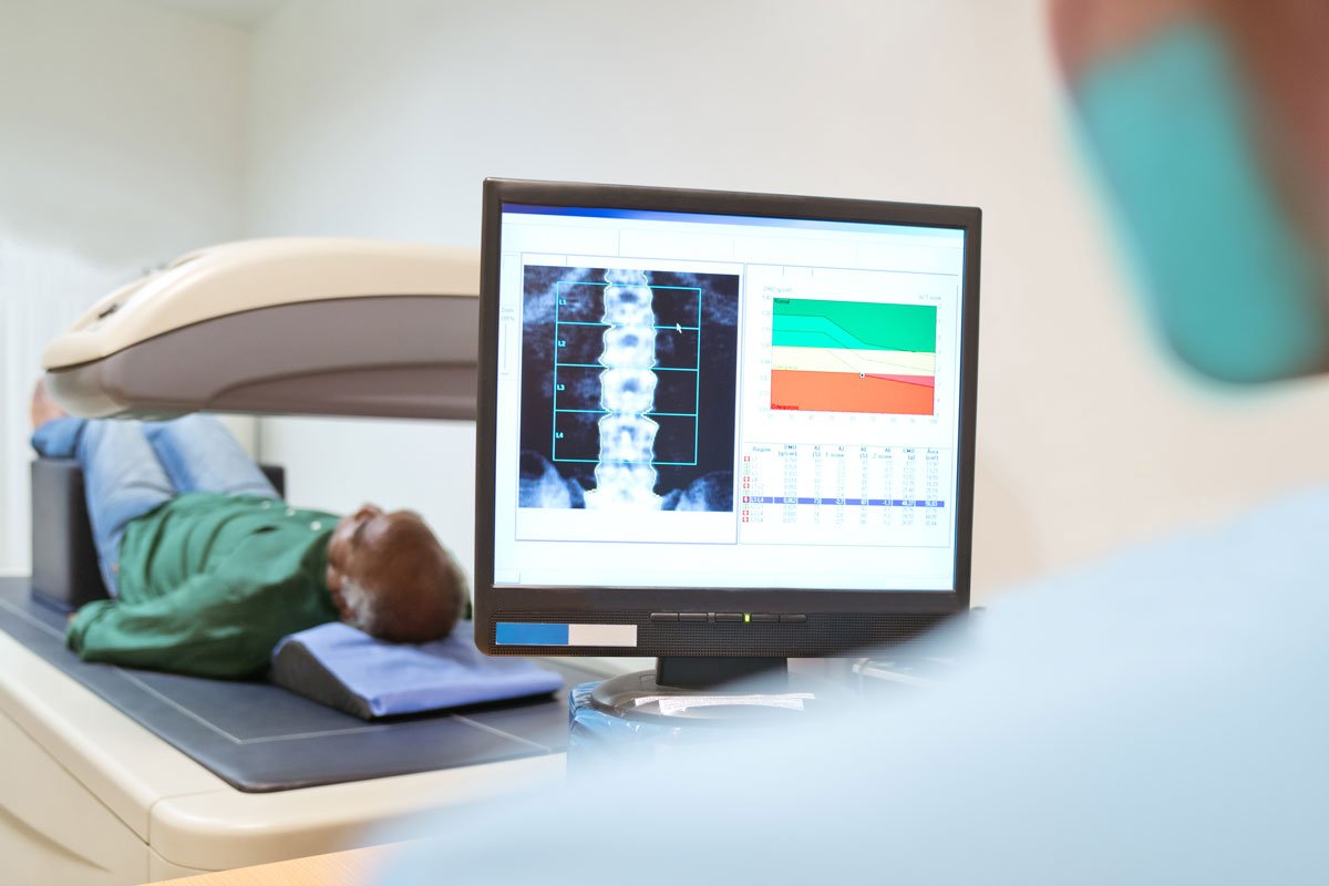 Bone Dexa - Medimaa Health